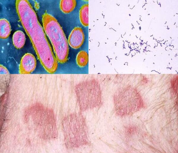 Bệnh đóng dấu lợn (Swine Erysipelas) - Tập đoàn Đức Hạnh Marphavet BMG